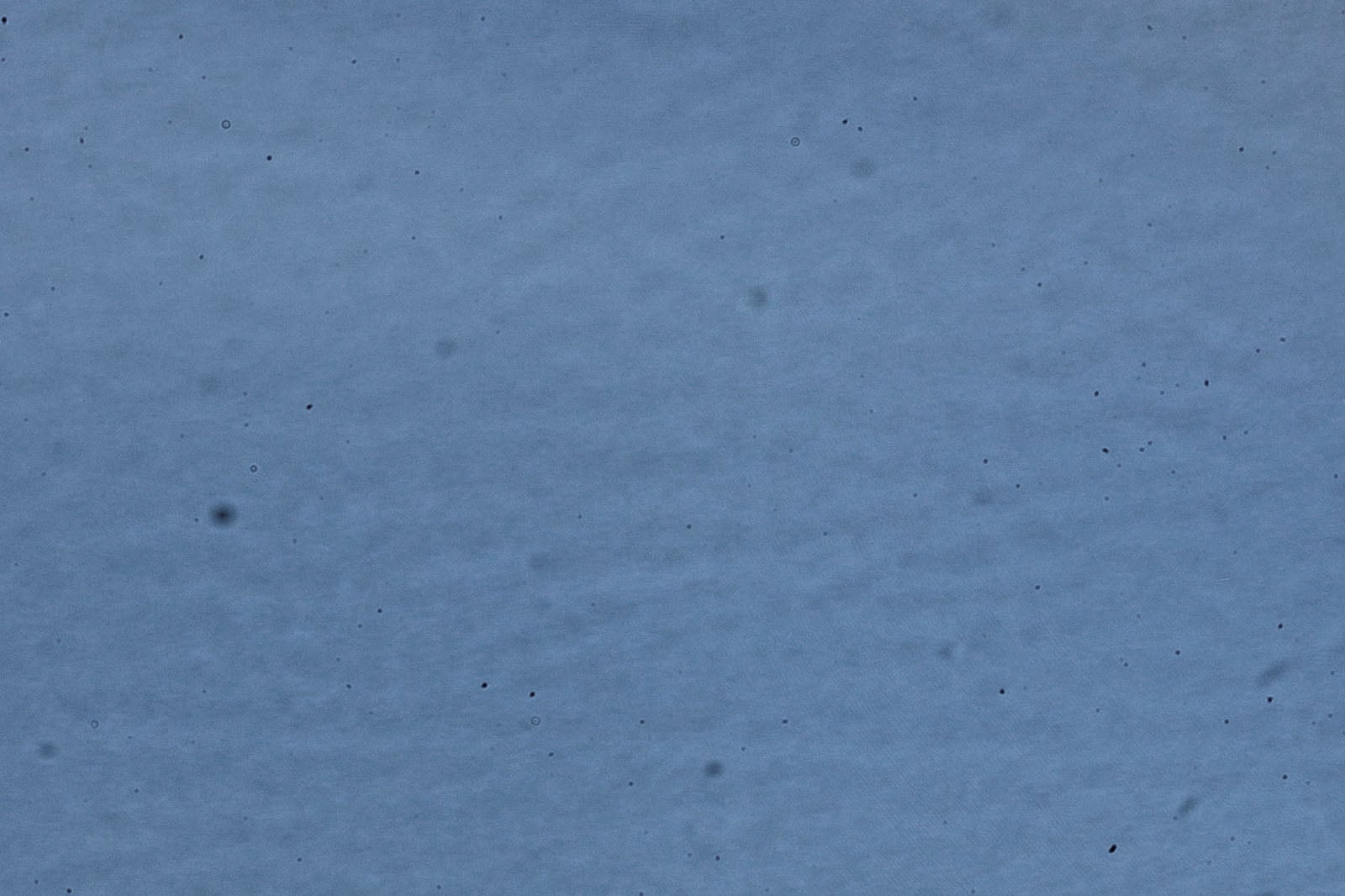 A Step-by-Step Guide to Cleaning Your Camera Sensor | PetaPixel