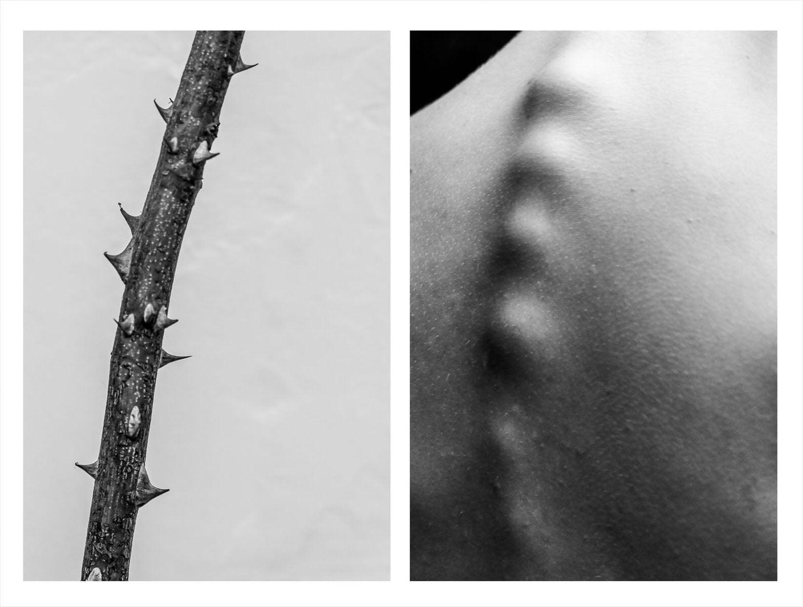 Photos That Show Similarities Between the Human Body and Nature | PetaPixel