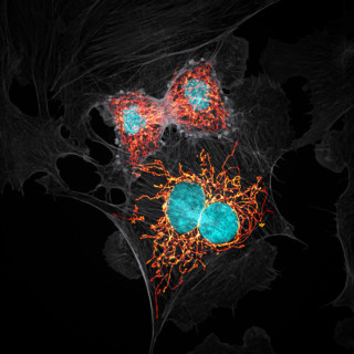 Beautiful Image of Turtle Embryo Wins Nikon Small World Photo Contest ...