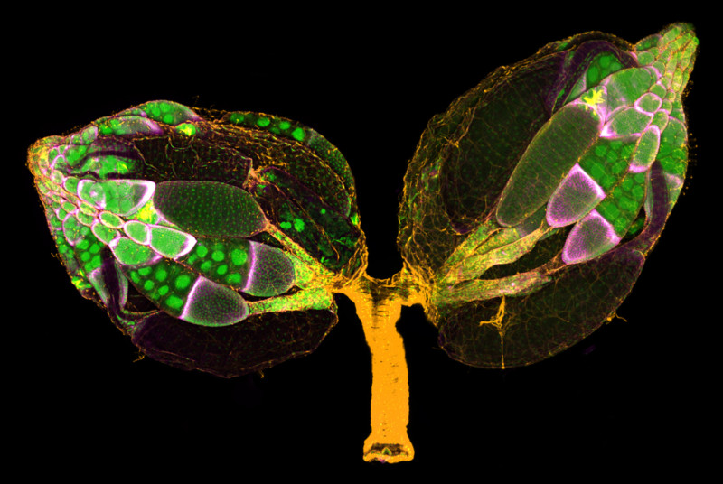Beautiful Image of Turtle Embryo Wins Nikon Small World Photo Contest ...