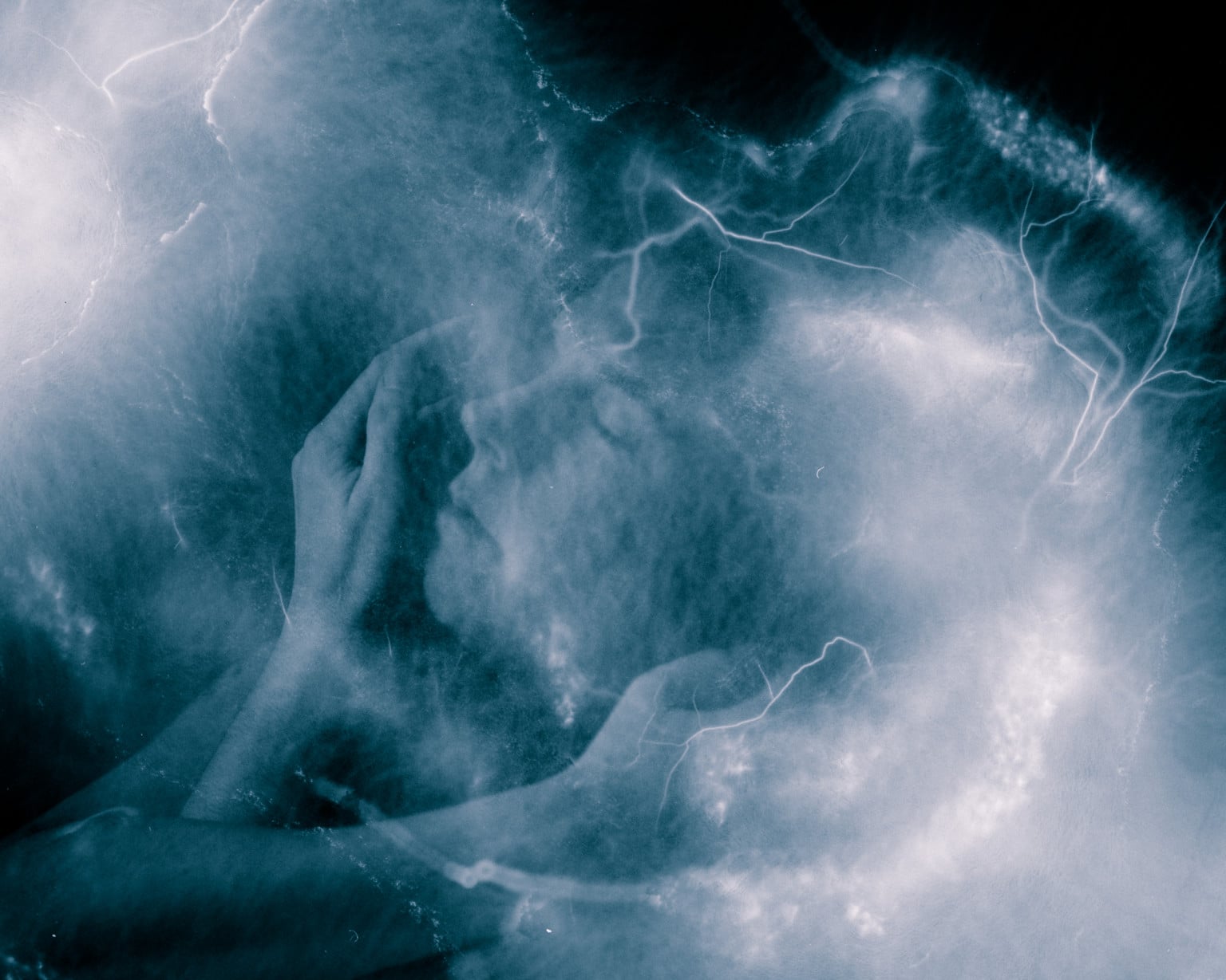 This is What Happens When You Zap Exposed Film with Static Electricity ...