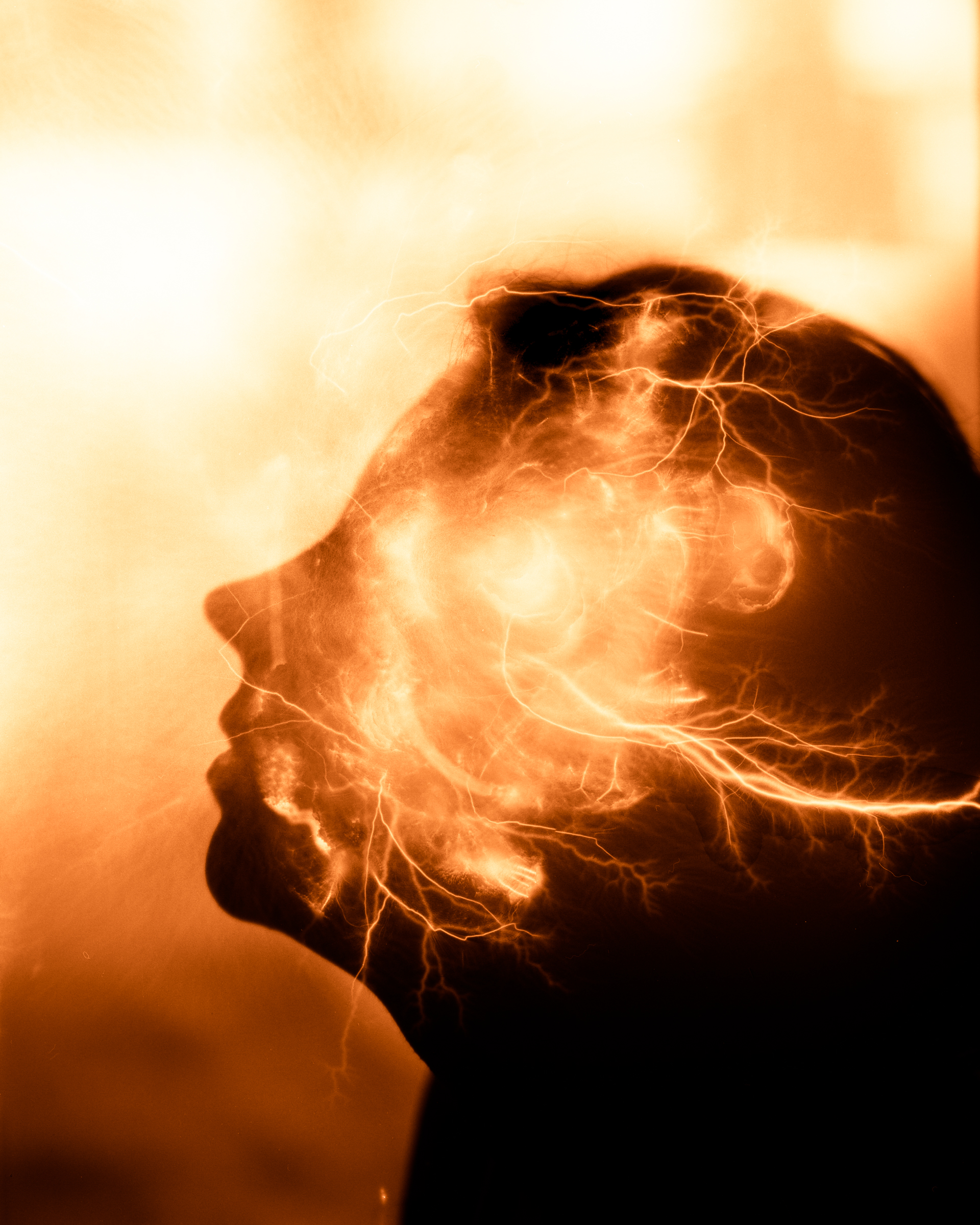 This is What Happens When You Zap Exposed Film with Static Electricity ...