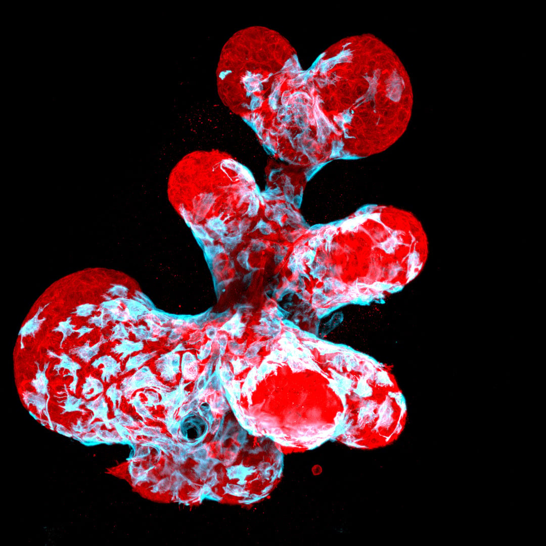 Microscopic Photo of an Oak Leaf Wins Nikon's Small World Competition ...