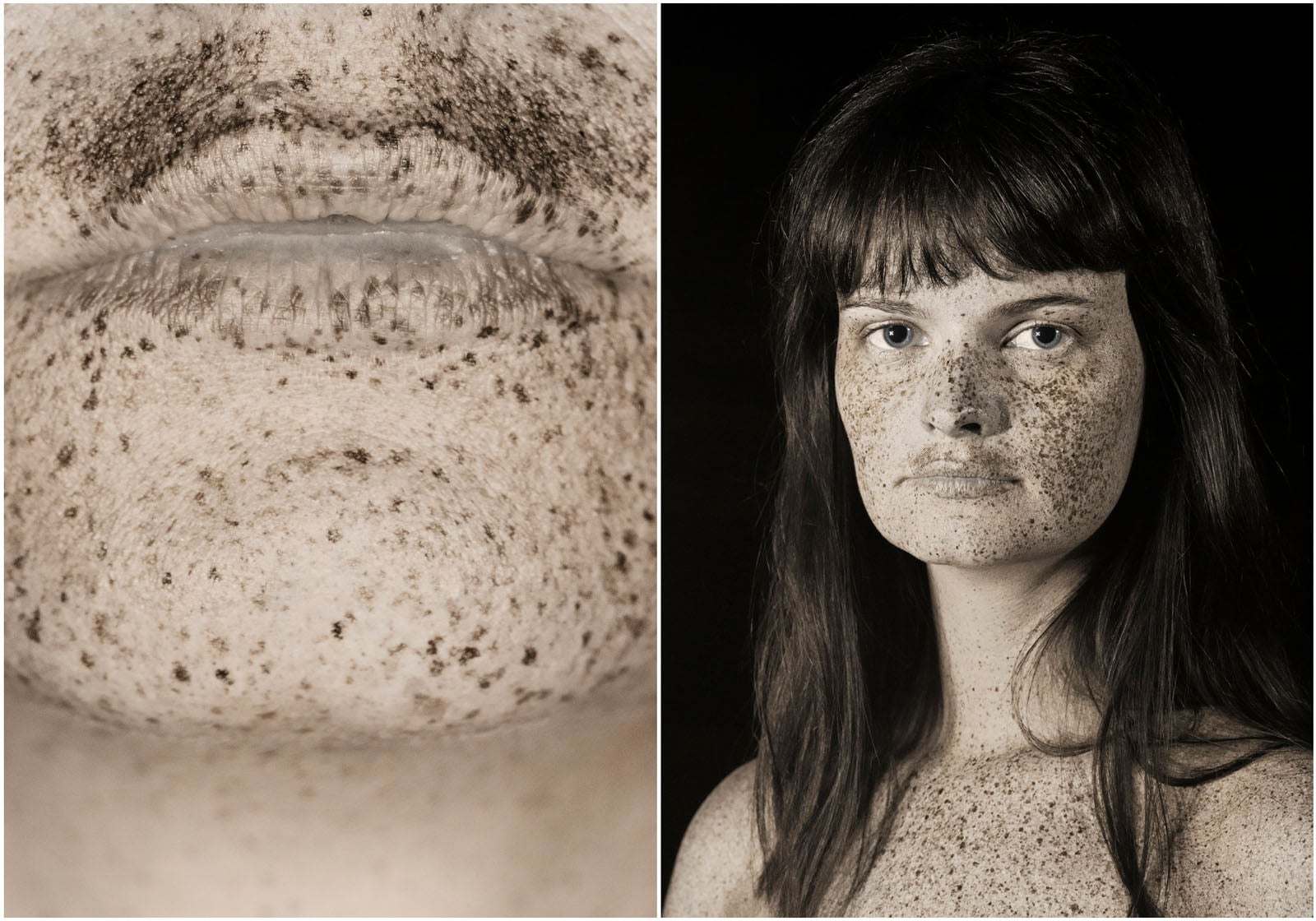 How UV Photography Can Revolutionize the Fight Against Skin Cancer ...