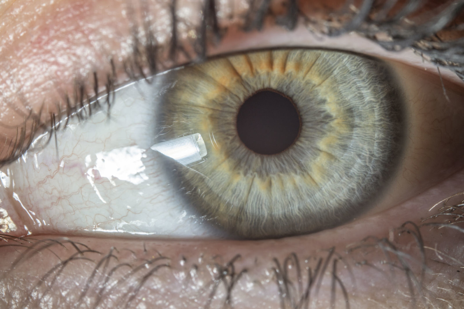 Aperture in Photography: A Complete Guide | PetaPixel