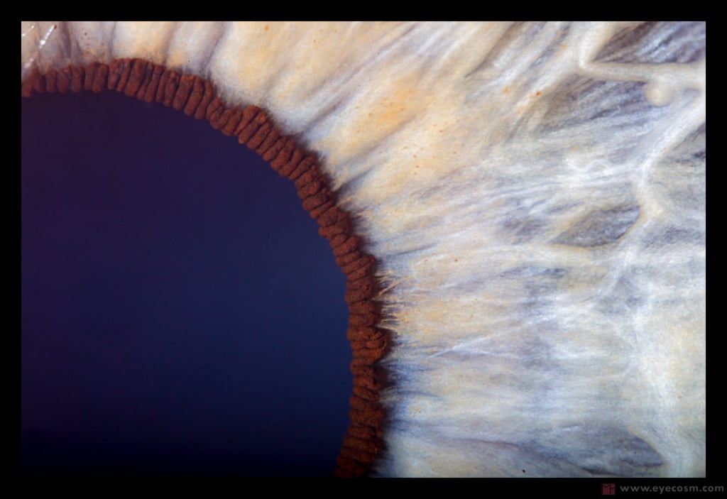 Extreme Eye Photos That Look Like an Aerial View of an Alien Landscape ...
