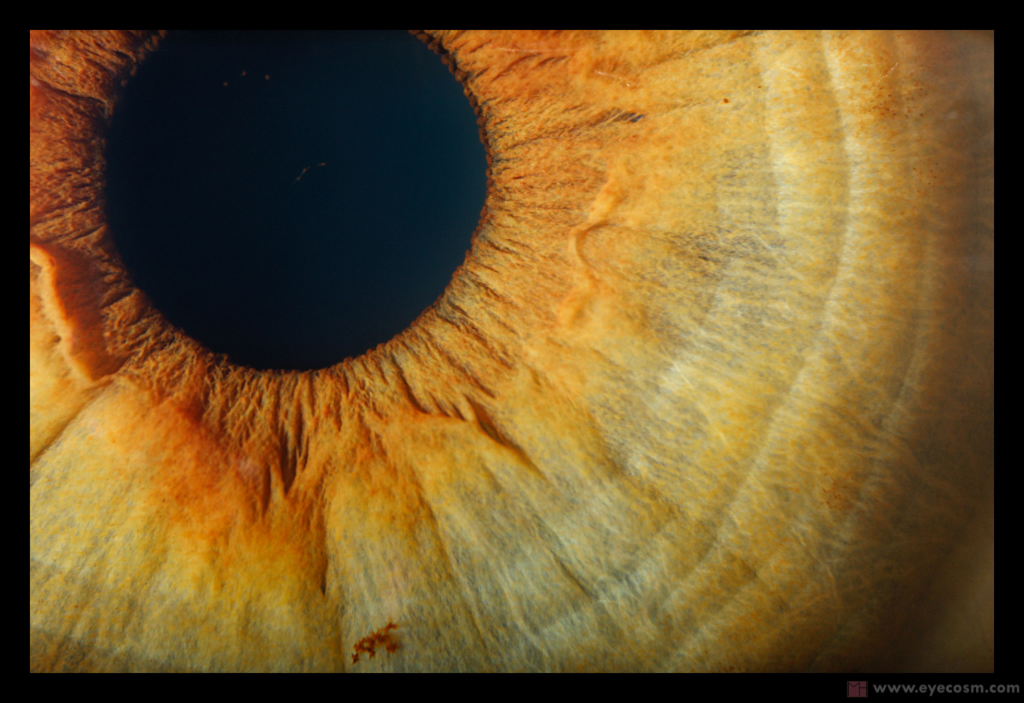 Extreme Eye Photos That Look Like an Aerial View of an Alien Landscape ...