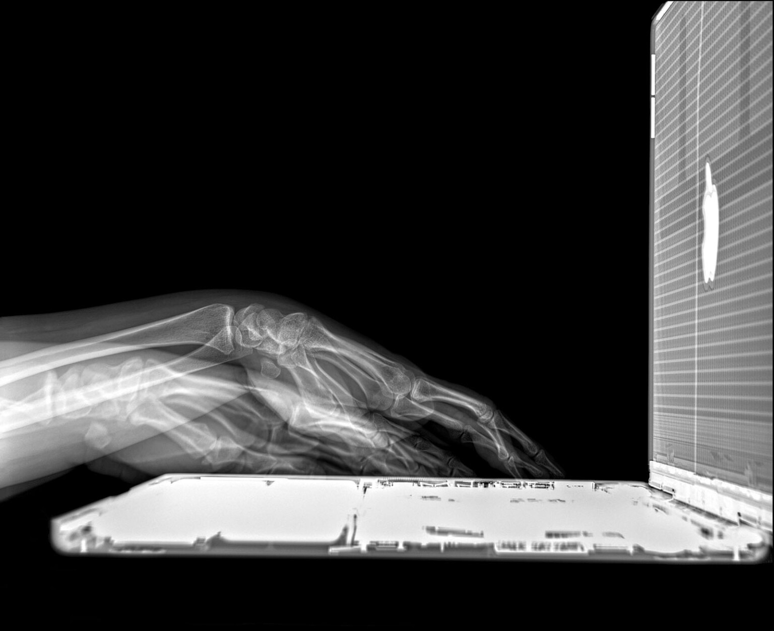 X-Ray Photo Series Shows Everyday Objects in an Incredible, Unique Way ...