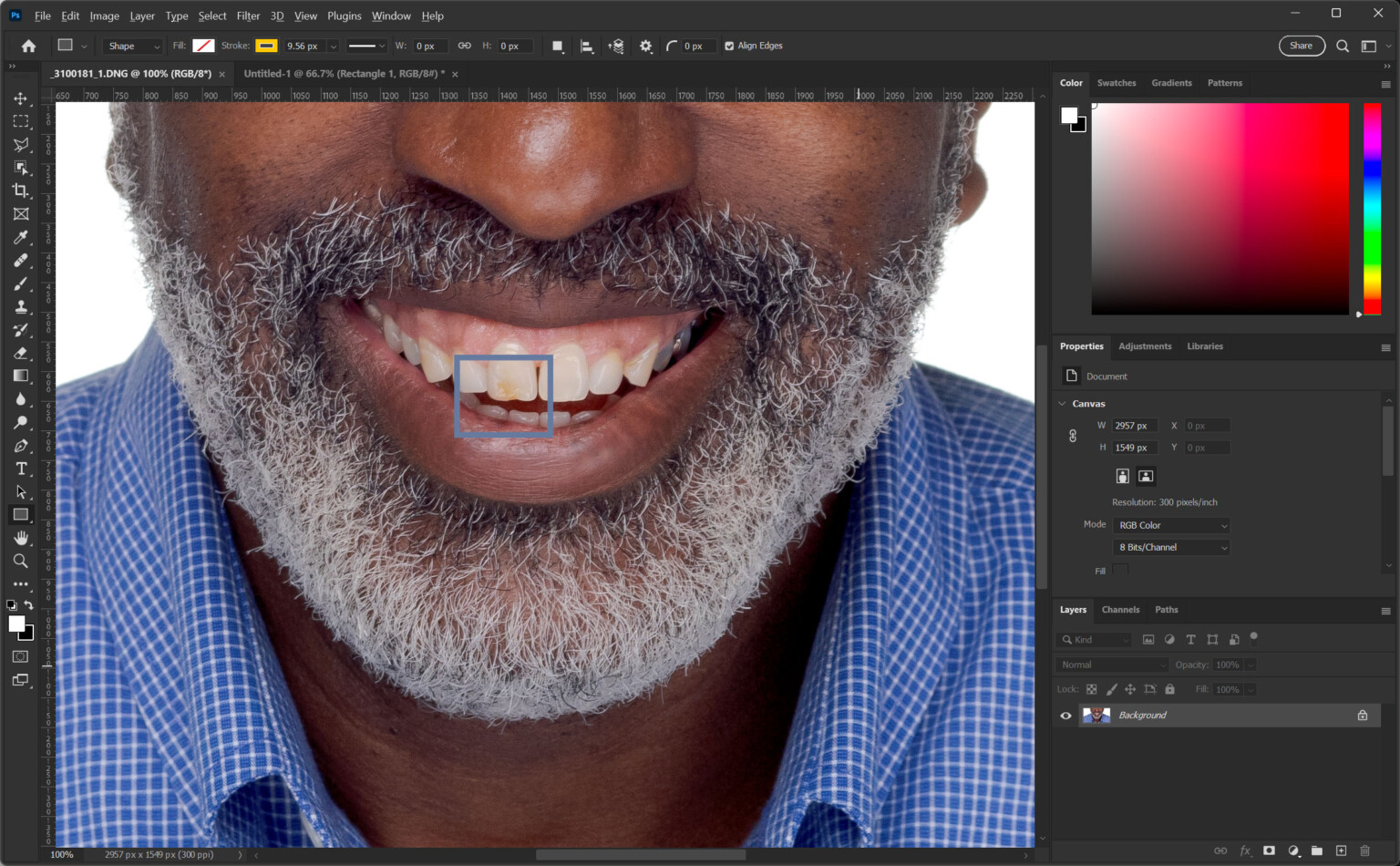 How to Whiten Teeth in Photoshop | PetaPixel