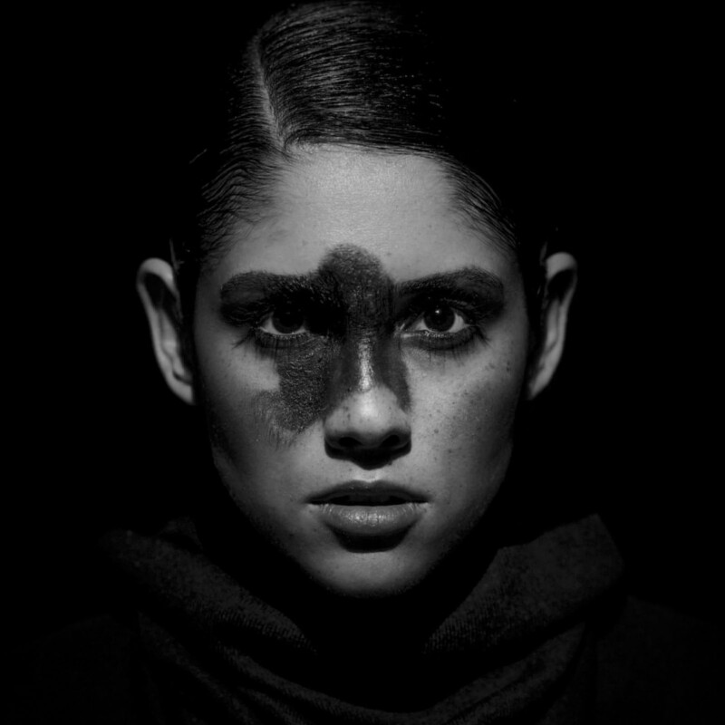 'Unusual Beauty' Photo Series Celebrates Rare Skin Conditions | PetaPixel