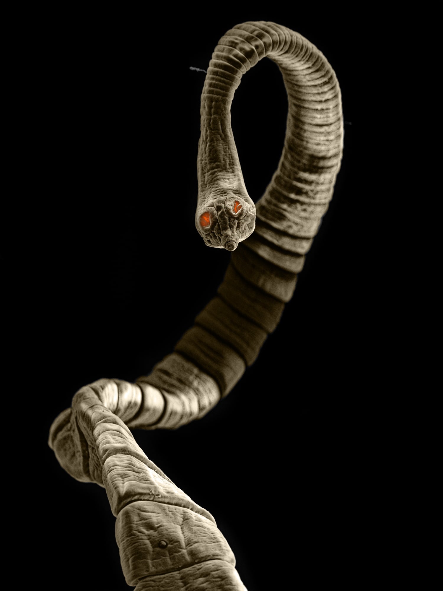 Photographer Captures the Terrifying Parasitic Worms That Live Inside ...