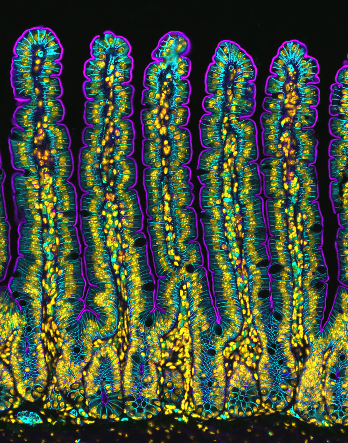Groundbreaking Close-Up of Brain Tumor Cells Wins Landmark 50th Nikon ...